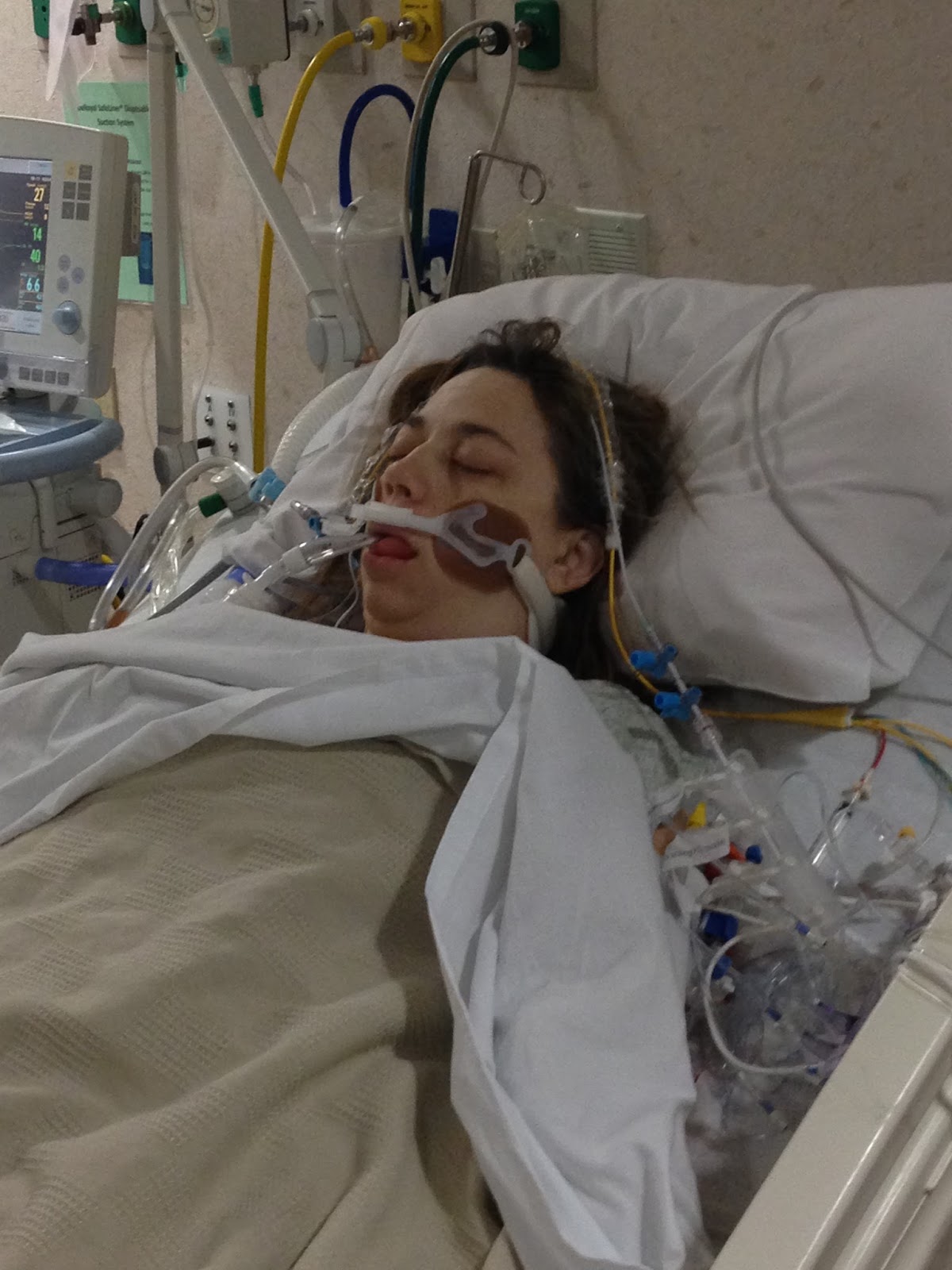 My life with B.O. :Bronchiolitis Obliterans not body odor :)