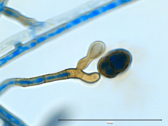 Fun With Microbiology (What's Buggin' You?): July 2015