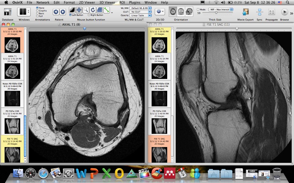 MRI and Medical Imaging: Extremities MRI scanners: exquisite, fast and ...