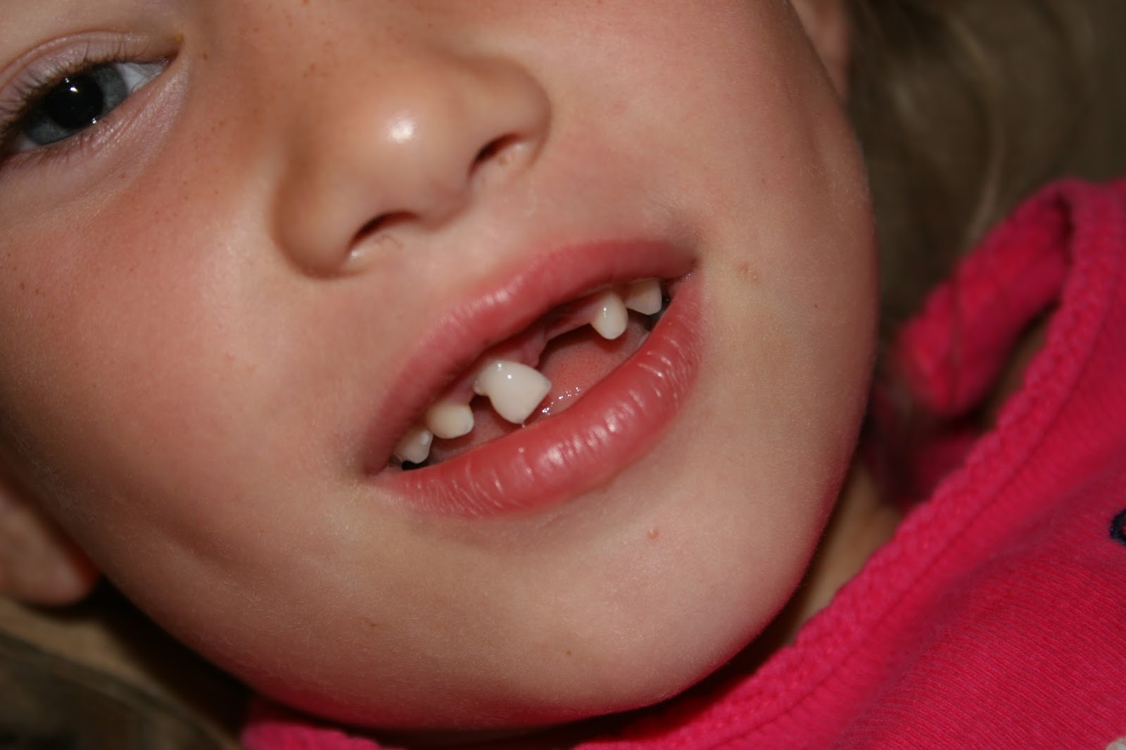 Little Hats: More...well Less Teeth!