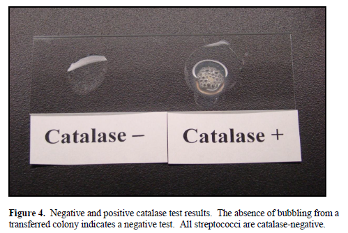 Identification and Characterization of Streptococcus Pneumoniae ...