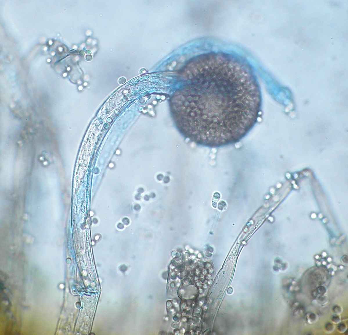 ATLAS MICOLOGIA: MUCOR CIRCINELLOIDES