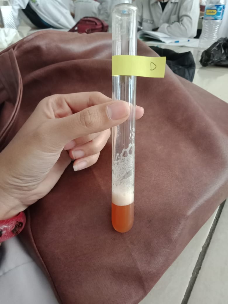 PEMBAHASAN LAPORAN PRAKTIKUM ENZIM KATALASE