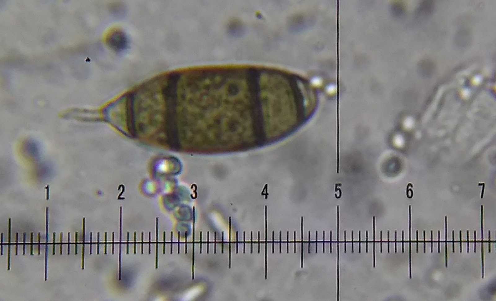 Myco Magic: Dematiaceous hyphomycetes