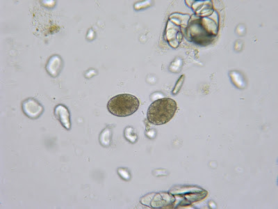 Fun With Microbiology (What's Buggin' You?): Diphyllobothrium latum ...