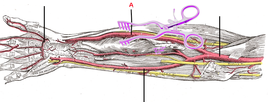 Radial Artery Anatomy And Clinical Notes Kenhub