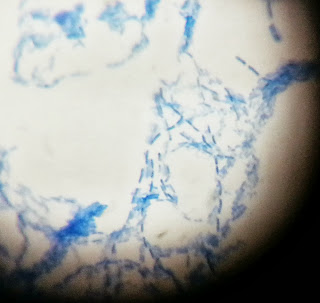 HicksMicro COURTESY Learning AID!: ACID FAST 8/22/22