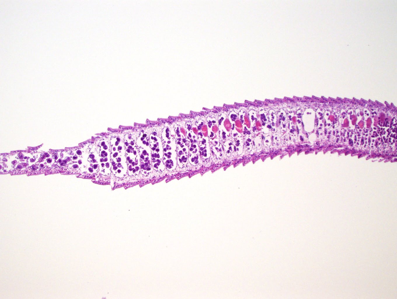 Creepy Dreadful Wonderful Parasites: Case of the Week 169