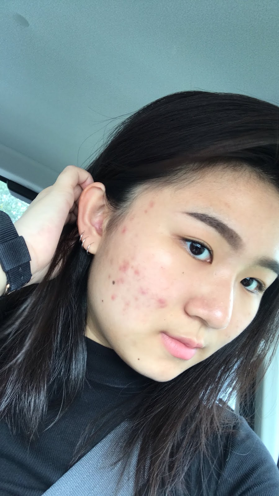 first facial experience @ One Doc Medical - Nourish to Flourish.