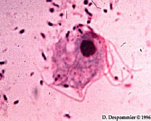 Lecture Notes in Medical Technology: Lecture #15: SUBPHYLUM MASTIGOPHORA