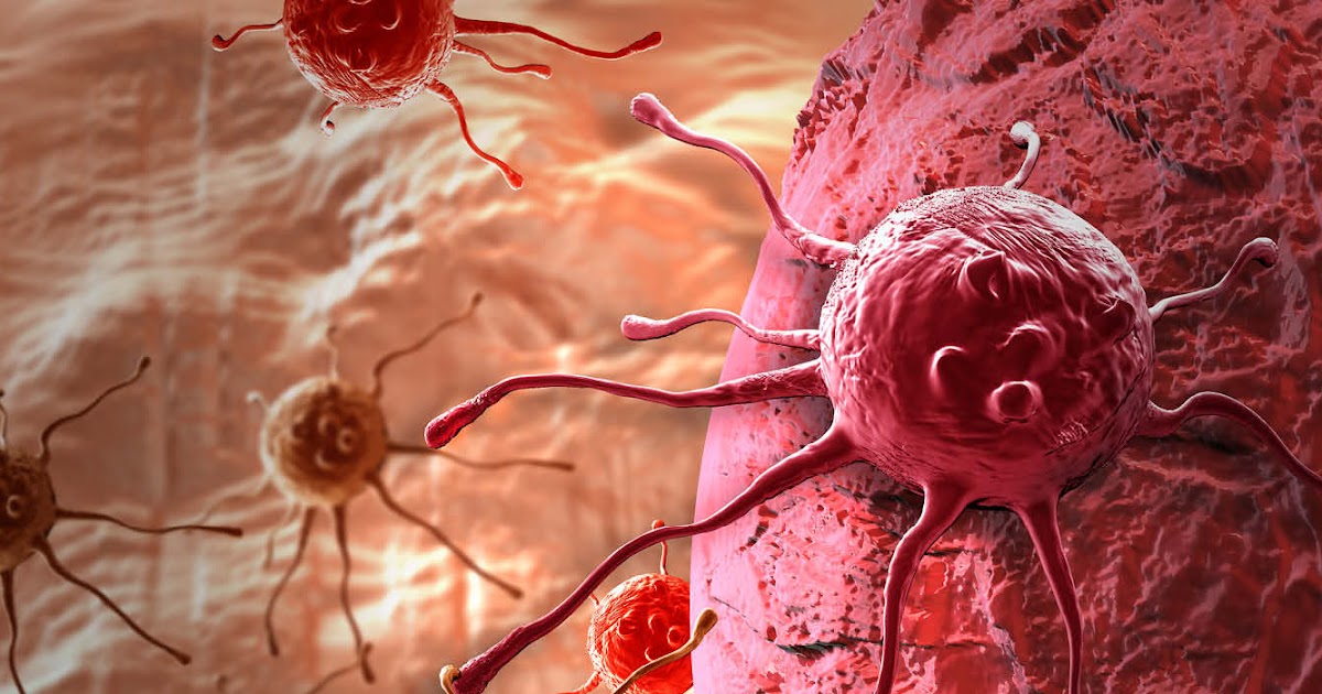 Tanda-Tanda Awal Kanser Yang Wajib Anda Tahu.