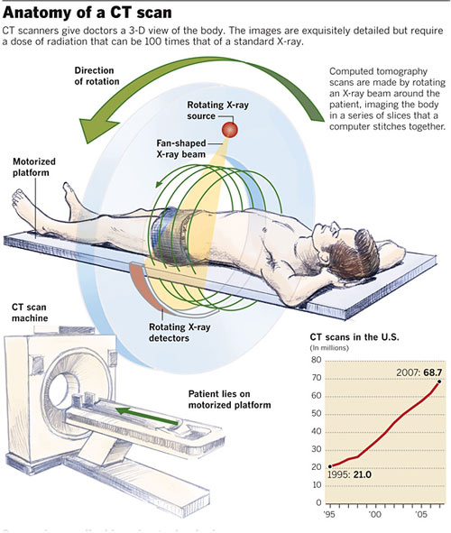 Creatio ex Nihillo: Roentgen, MRI, CT scan, USG --> Apa beda dan ...
