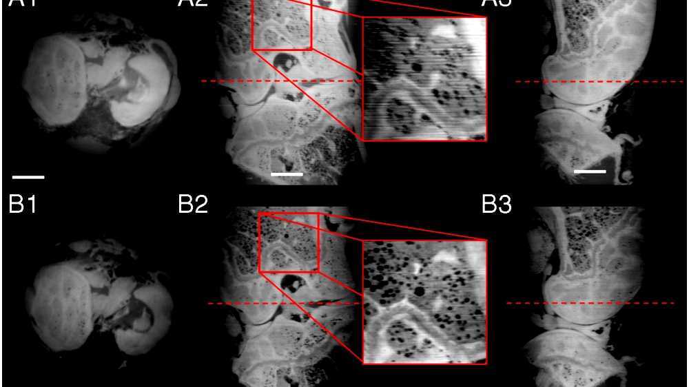 Phase-contrast X-ray imaging