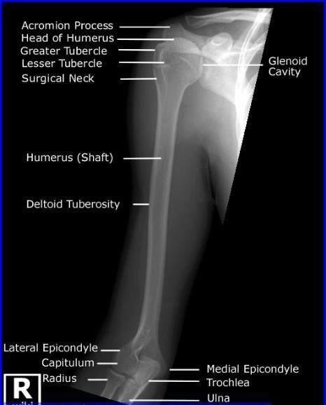 Assalamu Alaikum...: TEKNIK RADIOGRAFI EKSTREMITAS SUPERIOR
