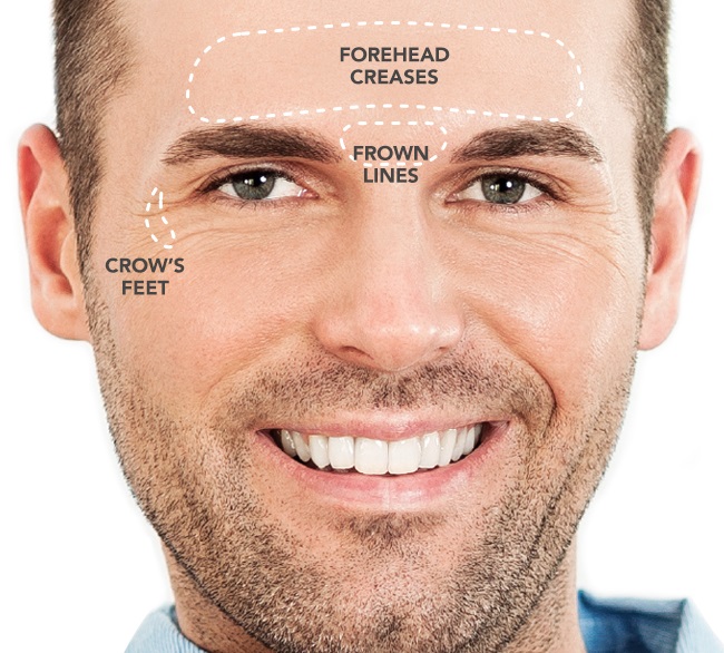 Selston Cosmetic Clinic: Botox Procedures For Todays Modern Man ...
