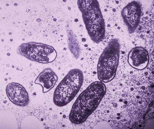 Lecture Notes in Medical Technology: Lecture #15: RICKETTSIA, CHLAMYDIA ...