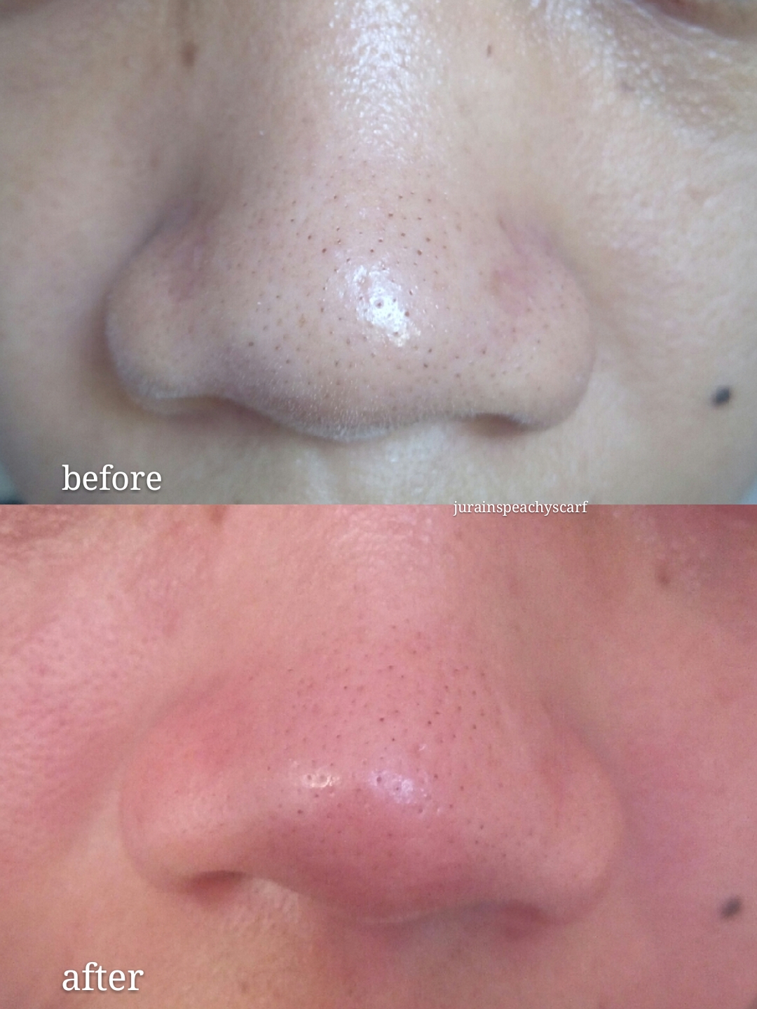 The Most Painful Mask!Megan Lift & Rejuvenating Peel-off Gel Mask with ...