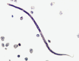 Ayna, picture and information: Whuchereria Bancrofti / Filaria