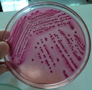 ROCHY CLASS: DALAM PEMERIKSAAN ESCHERICHIA COLI