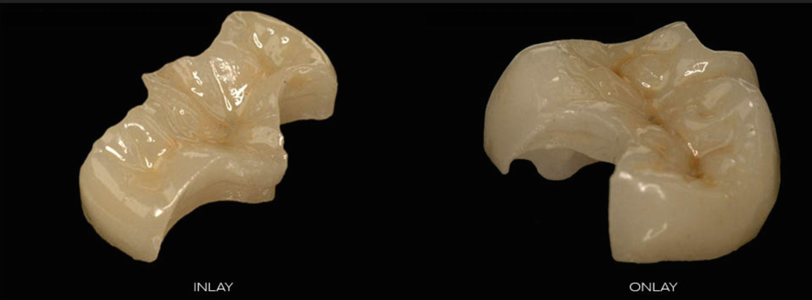 O que são próteses? ~ Blog Papo de Dentista