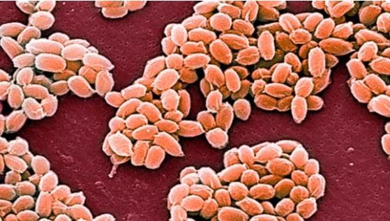 Long-dormant bacteria and viruses, trapped in ice and permafrost for ...