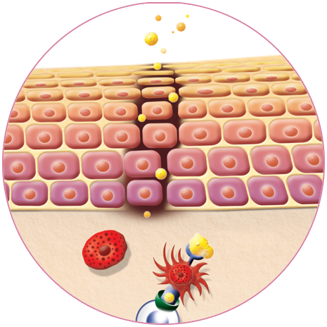 Clinica Veterinaria Torreblanca: ATOPIA. DERMATITIS ATÓPICA EN EL PERRO