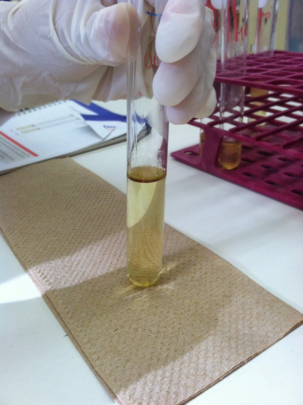 Rose & Lindsey's Medical Microbiology Blog: Indole (Tryptophan ...