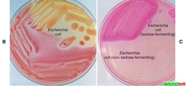 E. Coli Colony Morphology