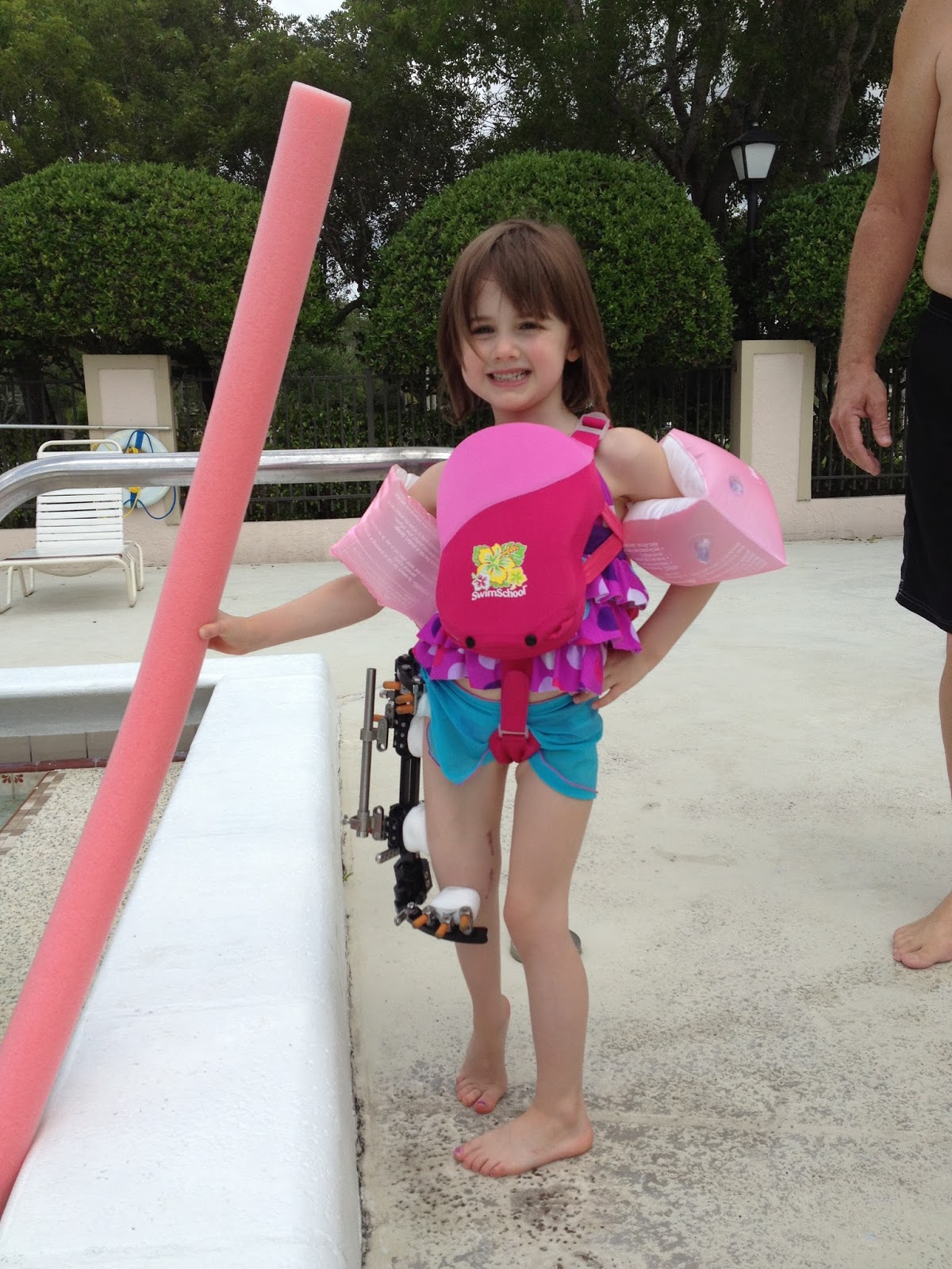 Madi's Milestones with PFFD: Seeing A Light At The End Of This Tunnel