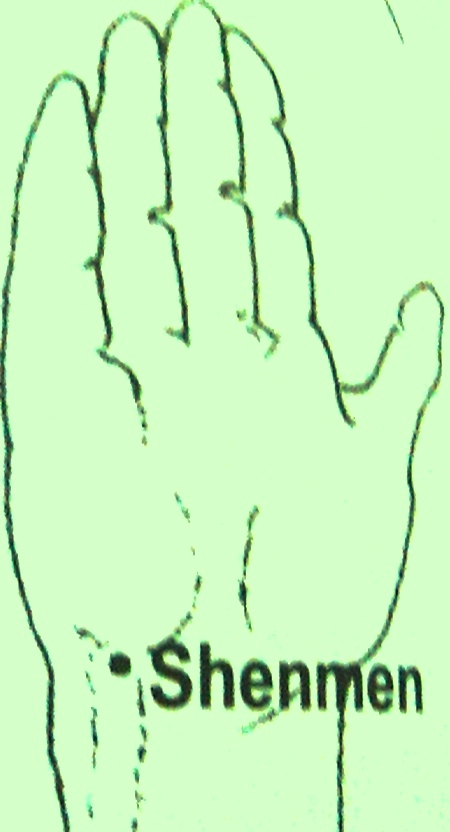 Akupuntur Akupresur Nanjing Jakarta Selatan: FA sebagai penyebab gagal ...