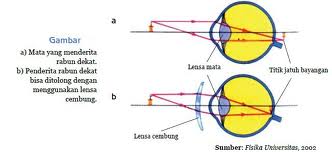 Alat-Alat Optik ~ ♥NannieN's♥