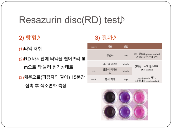 Preventive Dentistry: Snyder test, Cariescreen SM, Resazurin disc(RD) test