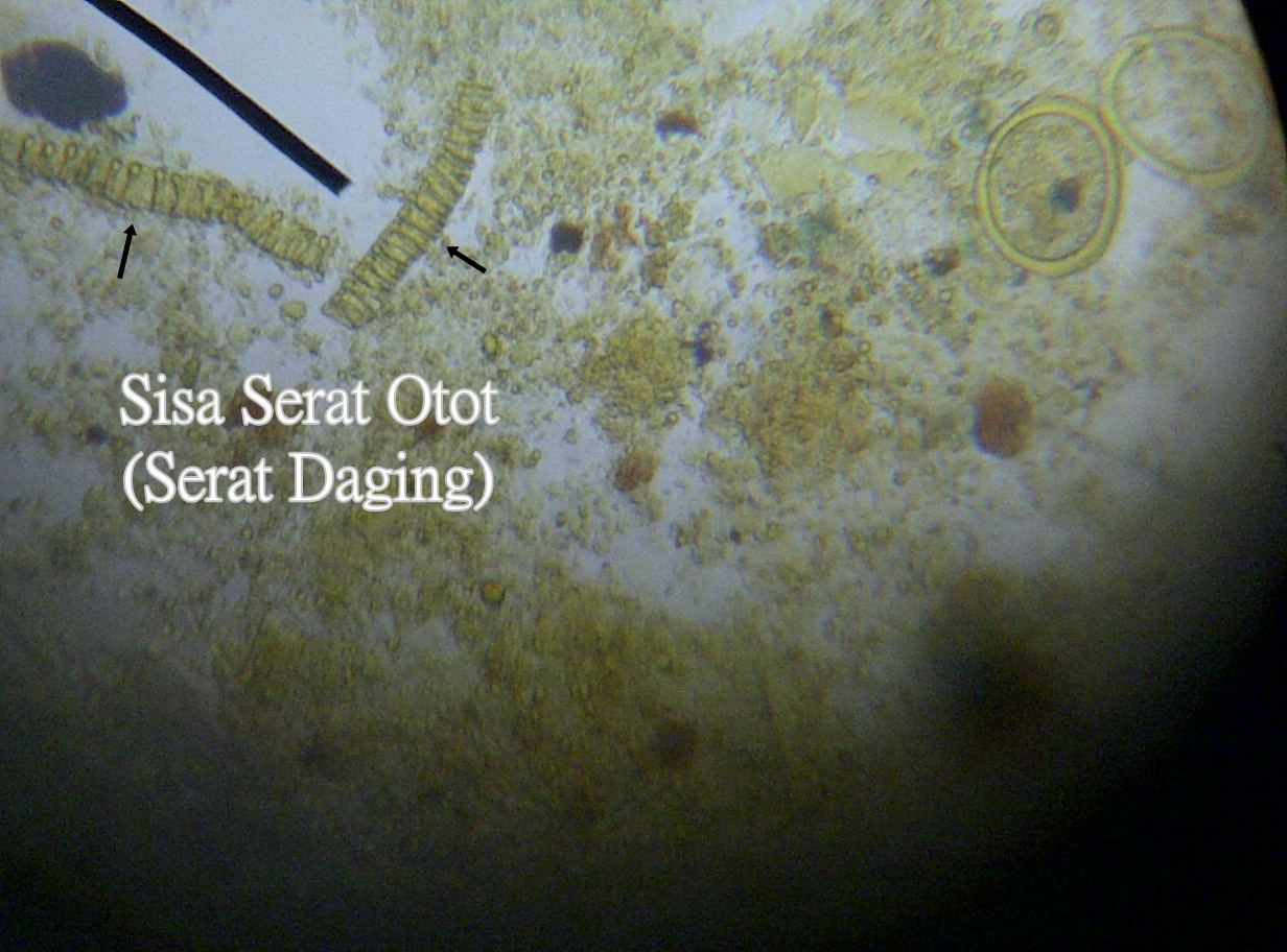 Rizqi Murtafi'ah: Pemeriksaan Feses Lengkap