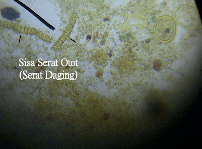 Rizqi Murtafi'ah: Pemeriksaan Feses Lengkap