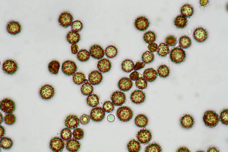 El mundo microscópico de los hongos: Pisolithus arhizus (Scop.per Pers ...