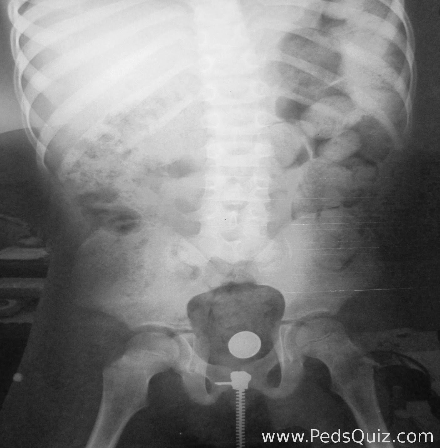Pediatric Image Quiz A Collection Of Interesting Images In Pediatrics pediatric-image-quiz-a-collection-of-interesting-images-in-pediatrics