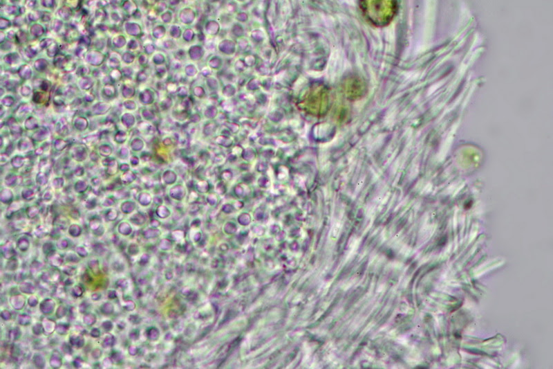EL MUNDO MICROSCÓPICO DE LAS PLANTAS: Xanthoria parietina (Liquen)