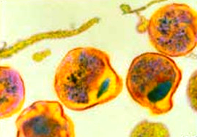 Clamidia ~ Tu Consulta Online antigua