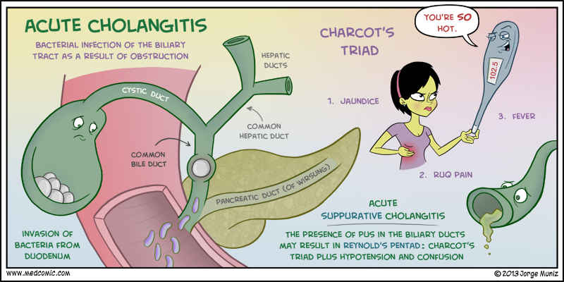 El día a día en el hospital: COLANGITIS