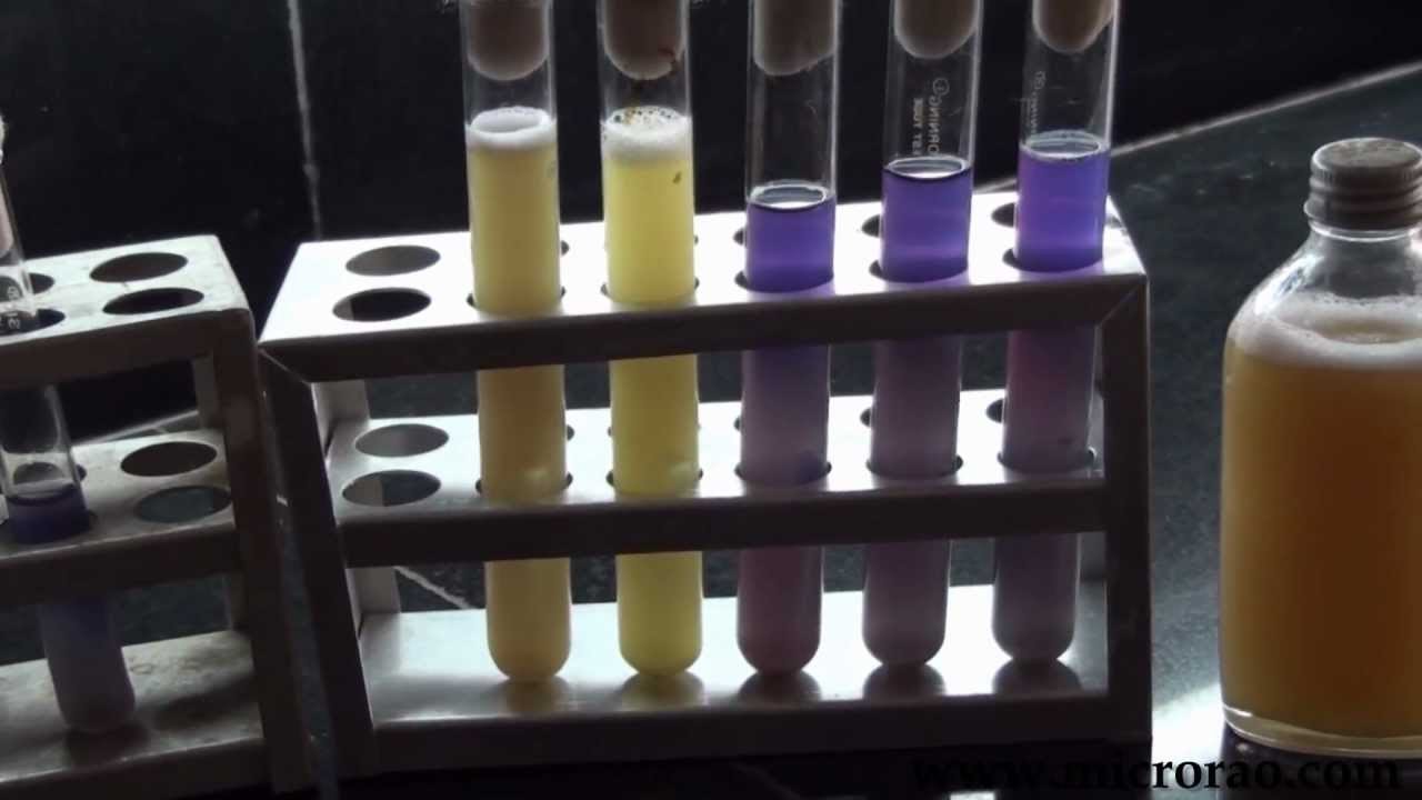 Bacteriological Water Analysis bacteriological-water-analysis