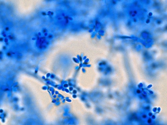 Fun With Microbiology (What's Buggin' You?): Sporothrix schenckii ...