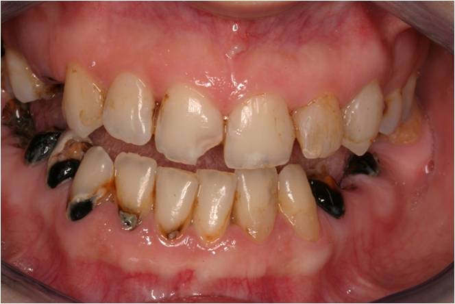 Cascadia Dentistry - Medical Dentistry,Cosmetics,& Implants: Don't Run ...