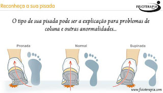 Bio Ego Saúde e Beleza: Reconheça a sua pisada