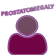 Prostatomegaly Grade 3 ~ Prostatomegaly Definition, Grades 1,2,3, 4 ...