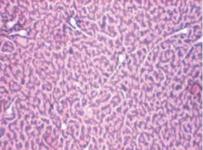 [Haematology] Atlas of Semen Analysis | Free Medical Atlas