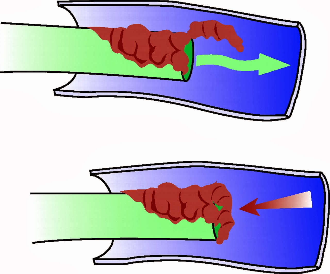 The Power is Love: No Candy Coating Here!
