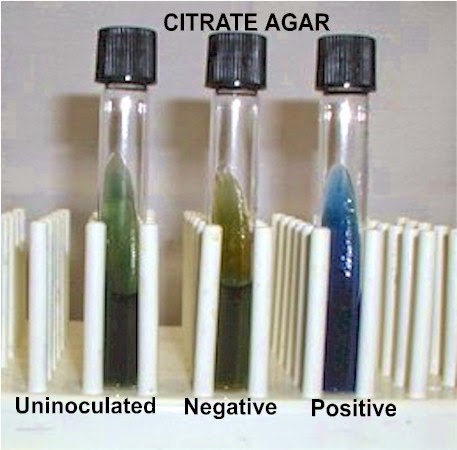 DISTANT LIBRARY: Voges Proskauer and Citrate Utilization Test For Bacteria