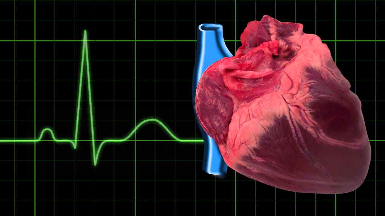 What are the signs and symptoms of a heart blockage?
