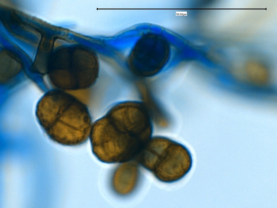 Fun With Microbiology (What's Buggin' You?): Stemphylium species