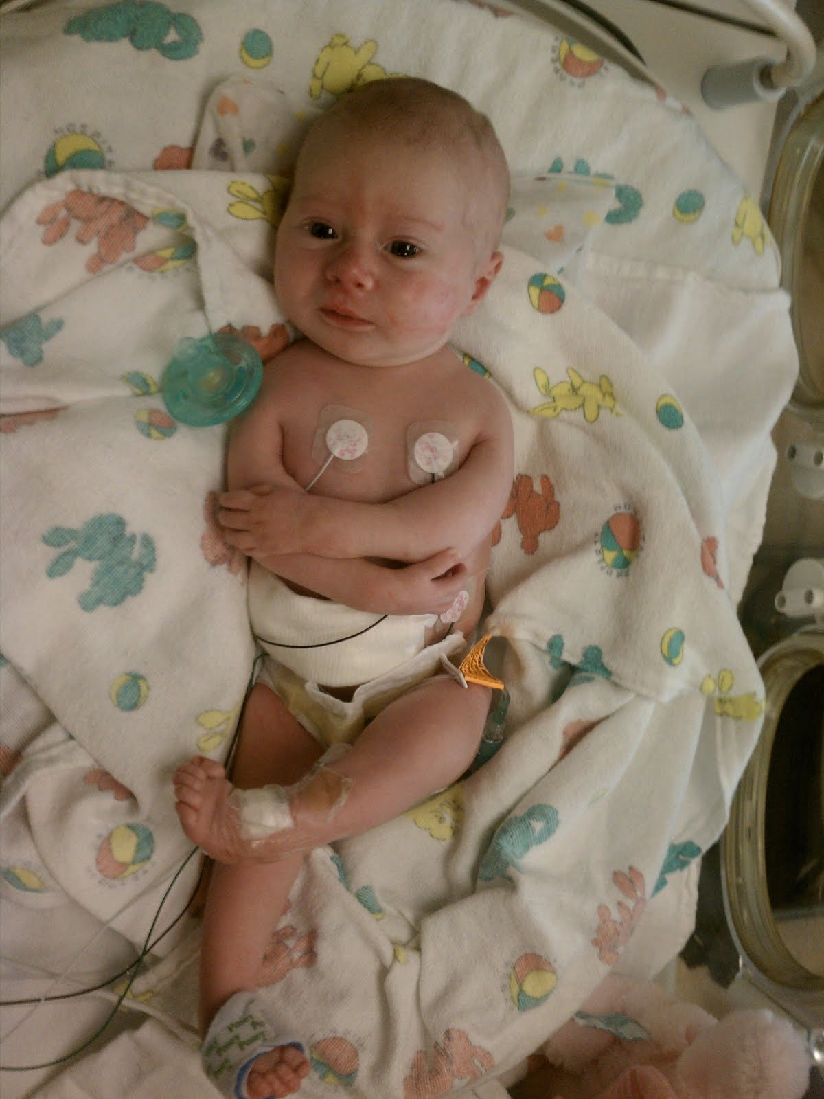 Sweet Analise Rose's Journey with Arthrogryposis, Amyoplasia type: Day ...